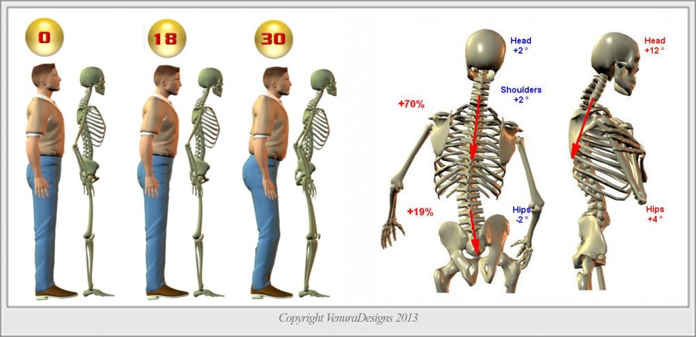 What Is Your Posture Number? | Mind & Body Chiropractic